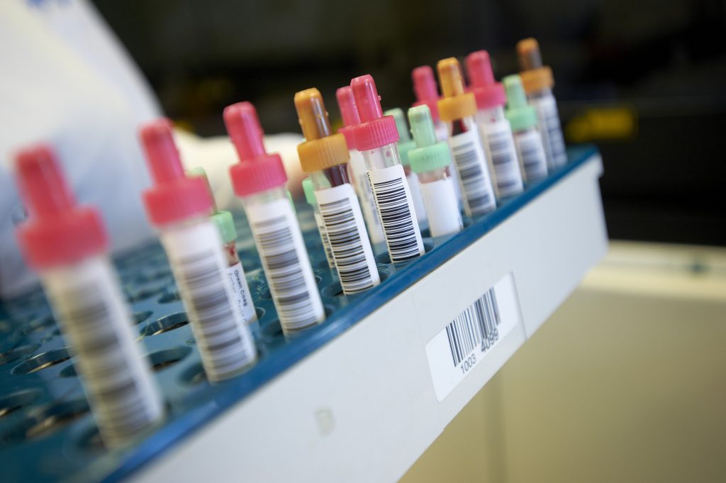 Esami Ematochimici: Scopri Quali Sono e a Cosa Servono!