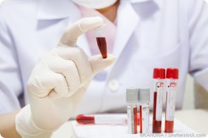 Lipasi Alta e Bassa: Scopri Tutte le Cause ed i Valori Normali!