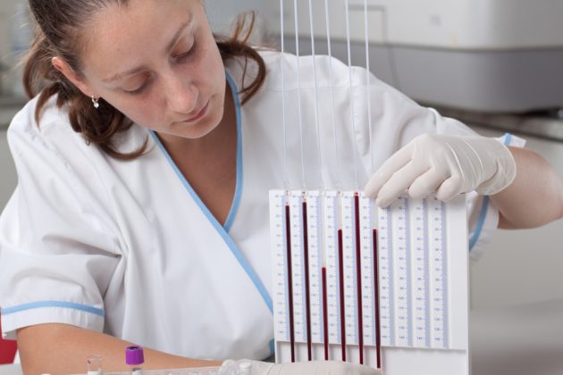 VES Alta e Bassa: Scopri Tutte le Cause ed i Valori Normali!