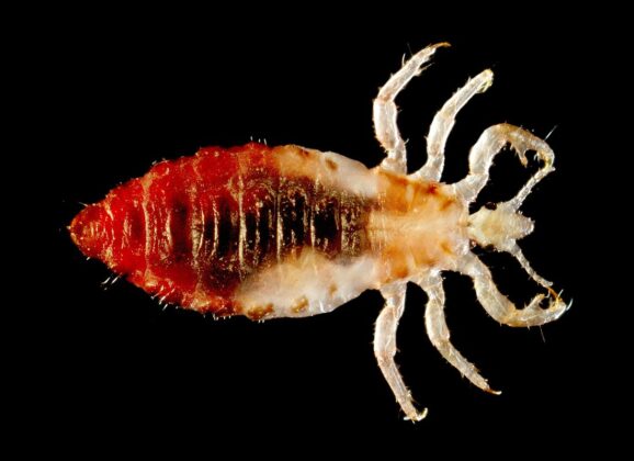 Pediculosi: come riconoscere, curare e prevenire i pidocchi - Salutarmente