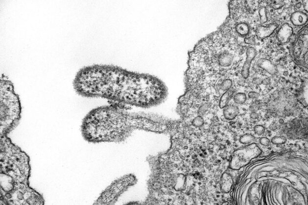 Febbre emorragica di Chapare: cause, sintomi e trattamento